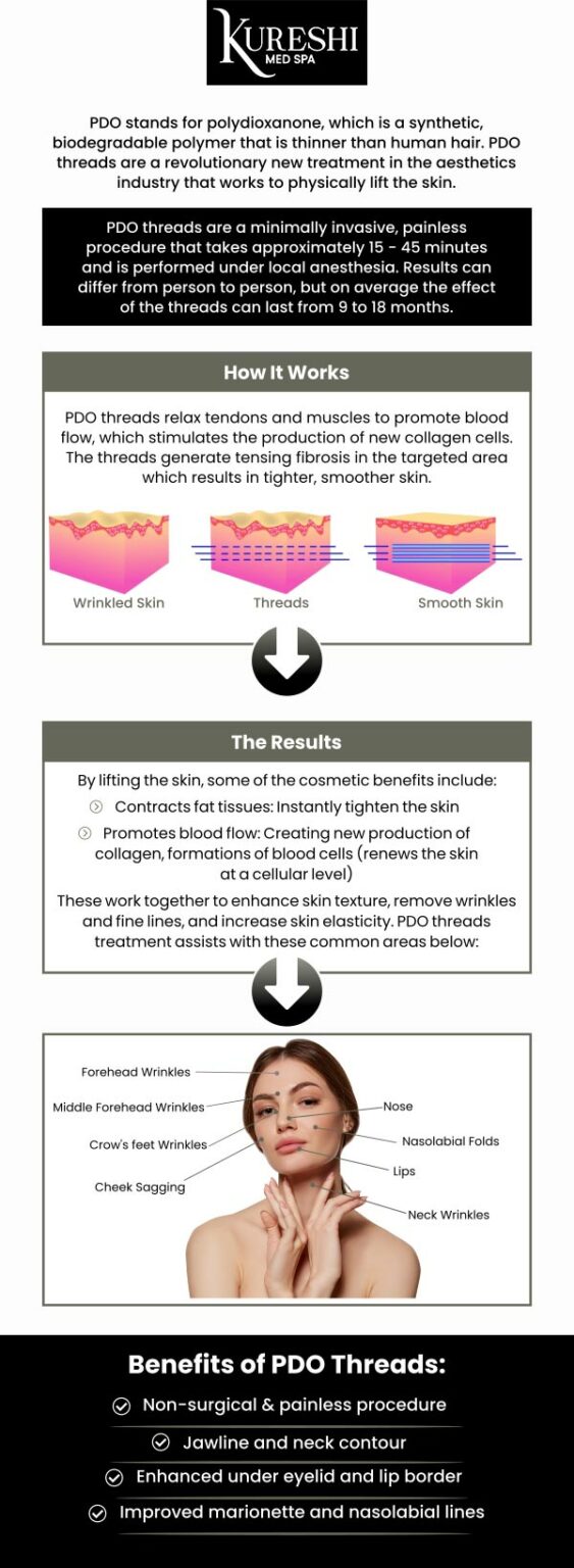 What Are the Benefits of PDO Thread Lifts?